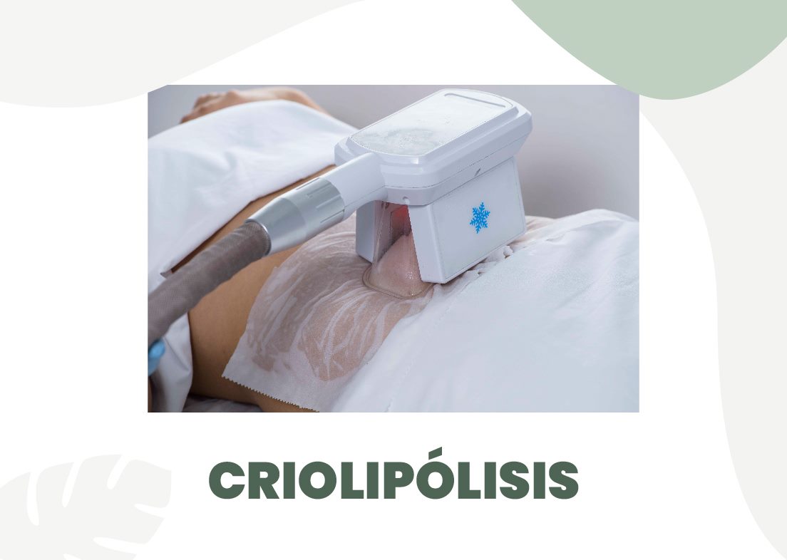 Tratamientos Faciales - Limpieza Facial